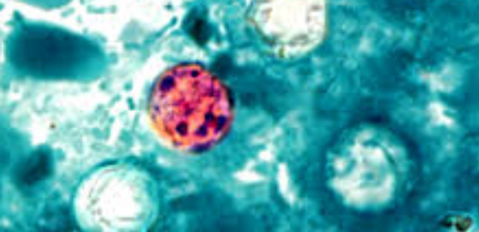 Cyclospora to Blame for Several Foodborne Outbreaks | Microbiology